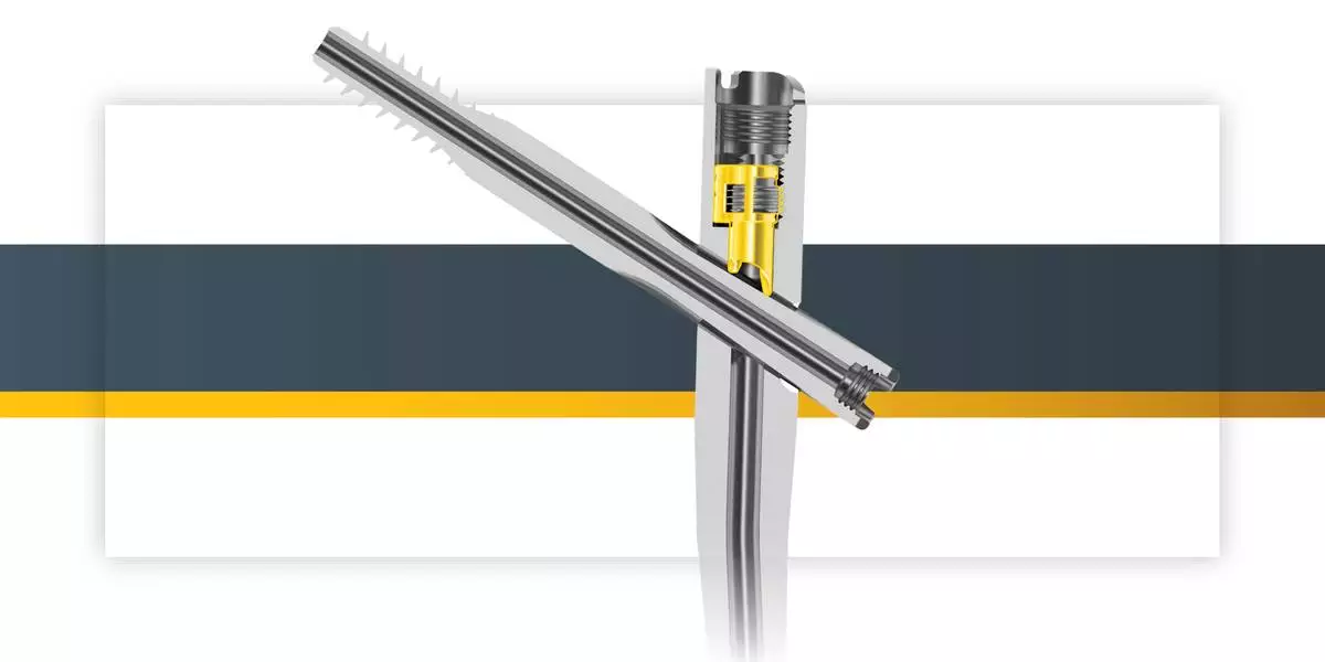 Stryker launches Gamma4 Hip Fracture Nailing System in Europe