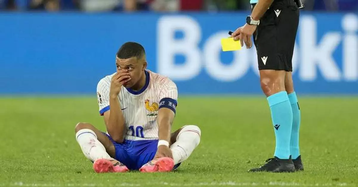 Kylian Mbappé trains at Euro 2024 with bandage on broken nose and ...