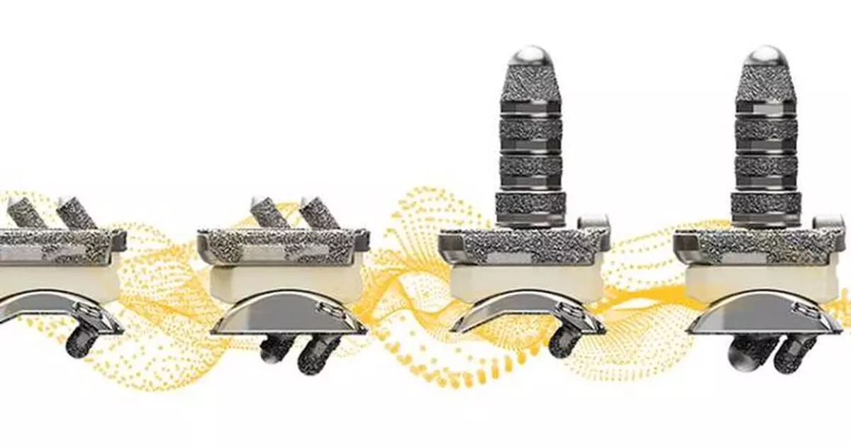 Stryker Launches Incompass Total Ankle System at AOFAS 2025