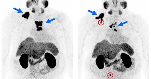 Copper-67 SAR-bisPSMA updates