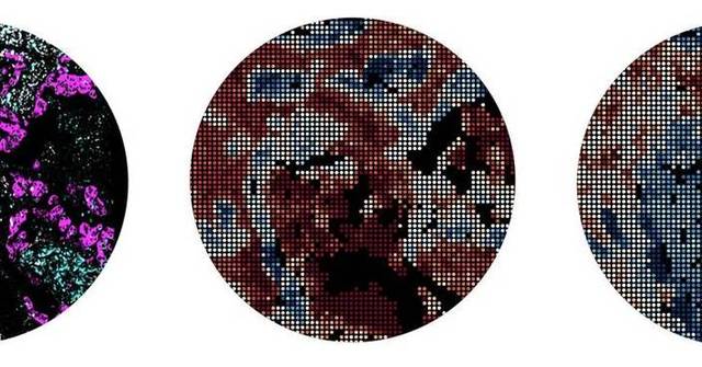 Noetik Announces First-in-Class Human Foundation Models for Discovery ...