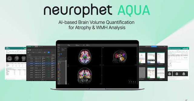 Neurophet Secures FDA 510(k) Clearance for Multiple Sclerosis Analysis ...