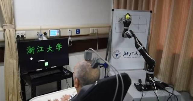 China makes new breakthroughs in clinical use of brain-computer interfaces