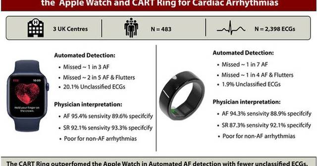 UK Clinical Study Finds Sky Labs' Smart Ring 'CART-I' More Sensitive ...