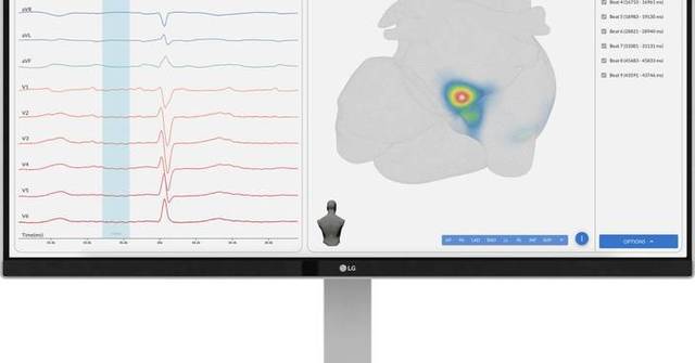 Vektor Medical Secures CE Mark for vMap, Bringing the Benefits of Non-Invasive Arrhythmia ...