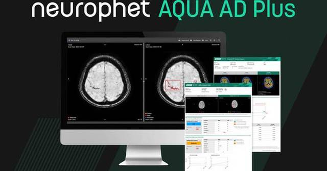 Neurophet Secures FDA 510(k) Clearance for "Neurophet AQUA AD Plus ...