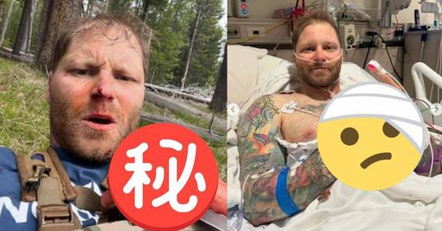 美漢森林徒步突遭護崽母熊狠咬險死 幸攜帶「1物」保命！